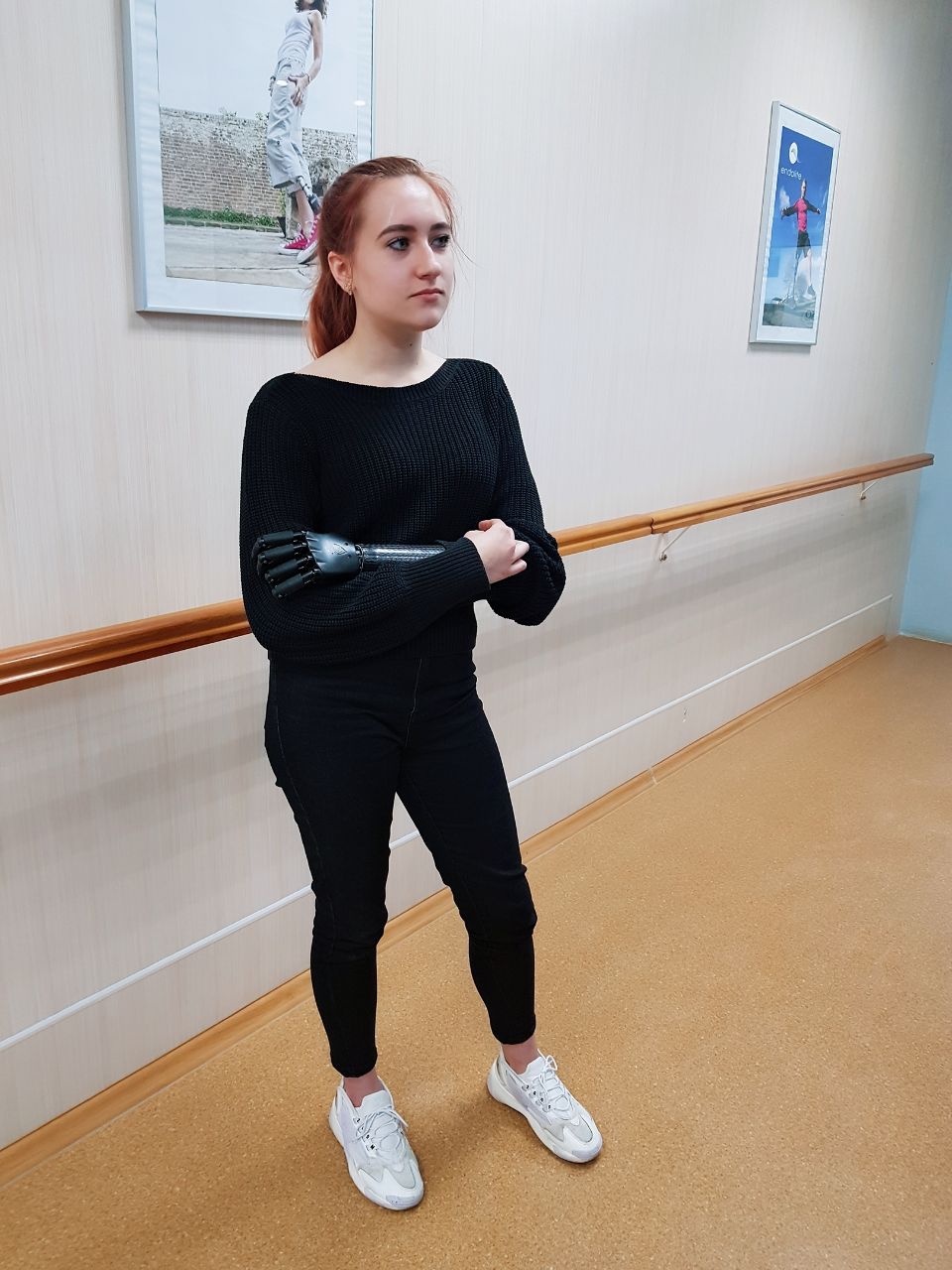 Студентка получила бионический протез кисти Vincent Systems - Endolite