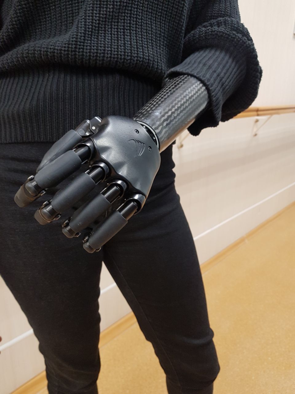 Студентка получила бионический протез кисти Vincent Systems - Endolite