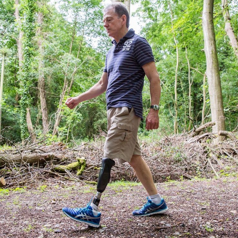 Электронный коленный модуль Orion3 к протезу бедра -Endolite