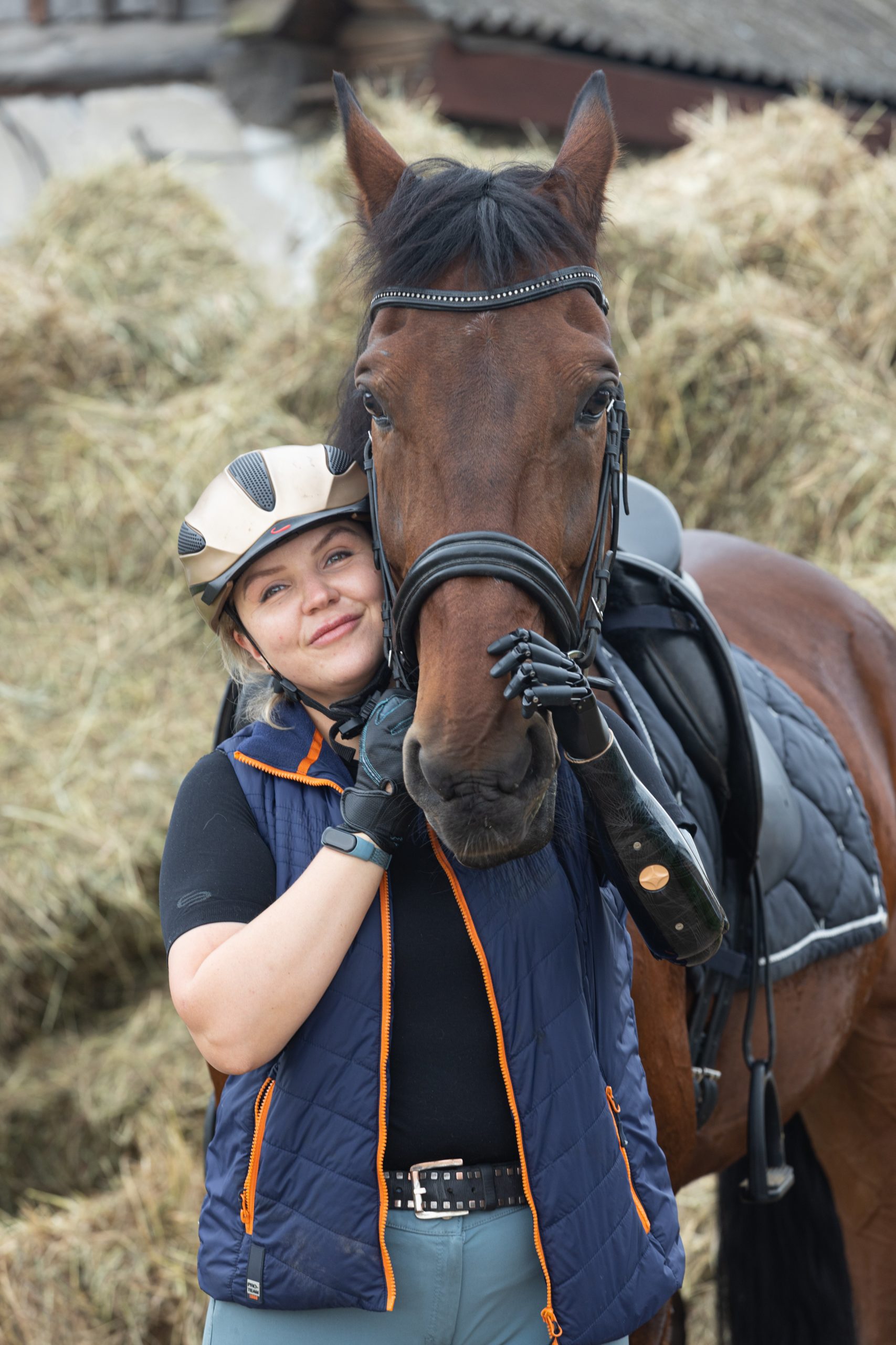 История Веры Шатиловой с бионической кистью Vincent Systems - Endolite