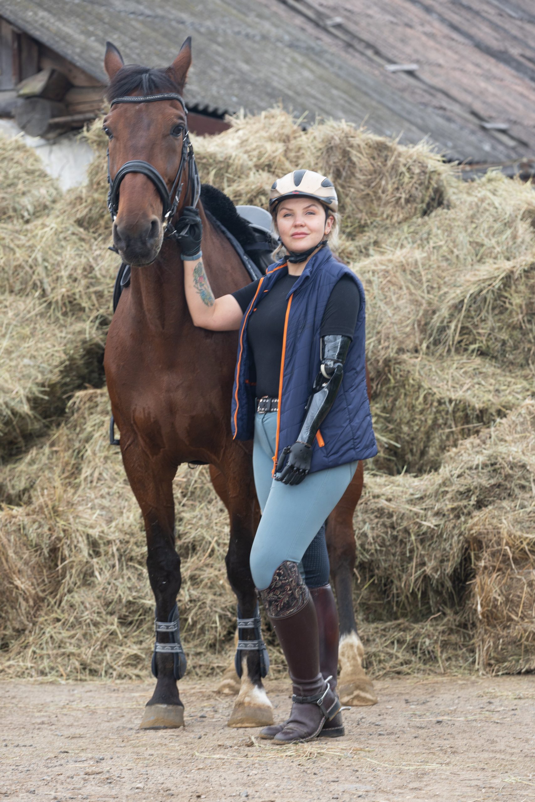 История Веры Шатиловой с бионической кистью Vincent Systems - Endolite