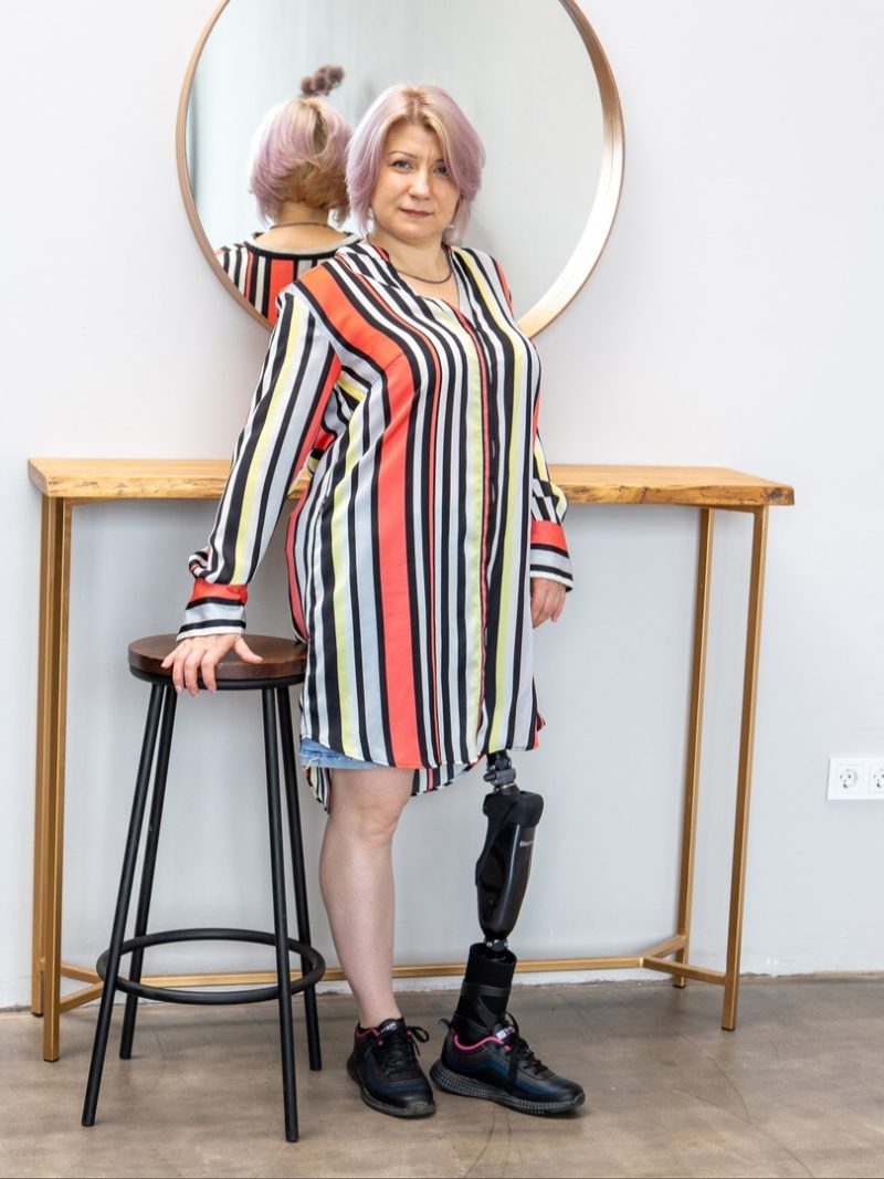 Протез бедра - Endolite